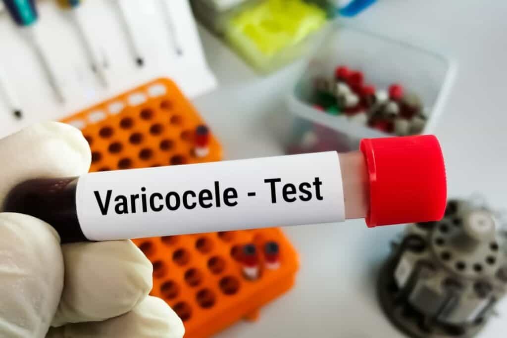 Come trattare il testosterone alto nell'uomo e cosa comporta